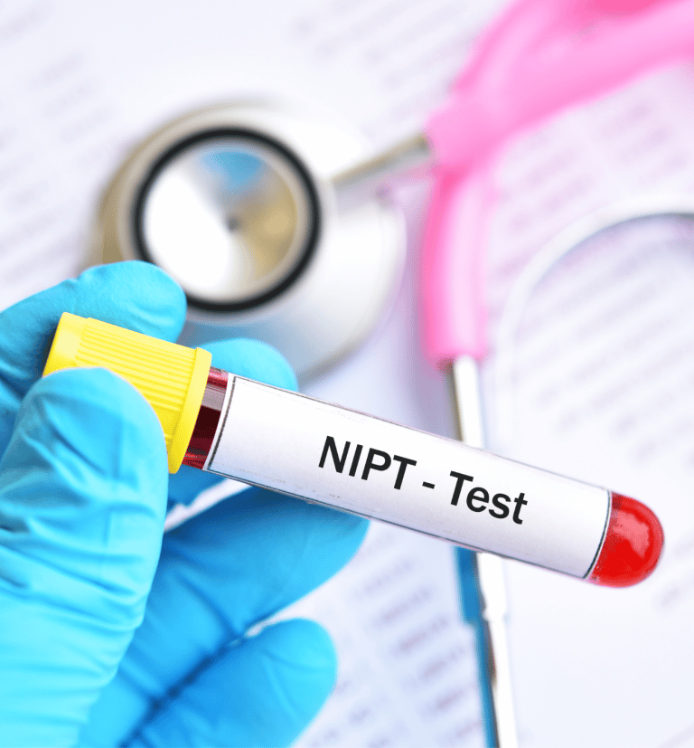 11 Week Ultrasound Scan - MyBump2Baby