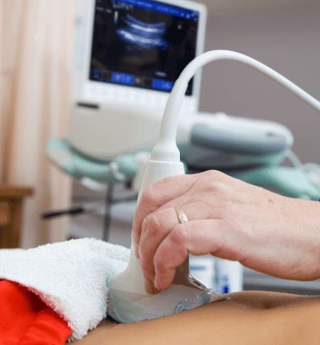 9 Week Ultrasound Scan - MyBump2Baby